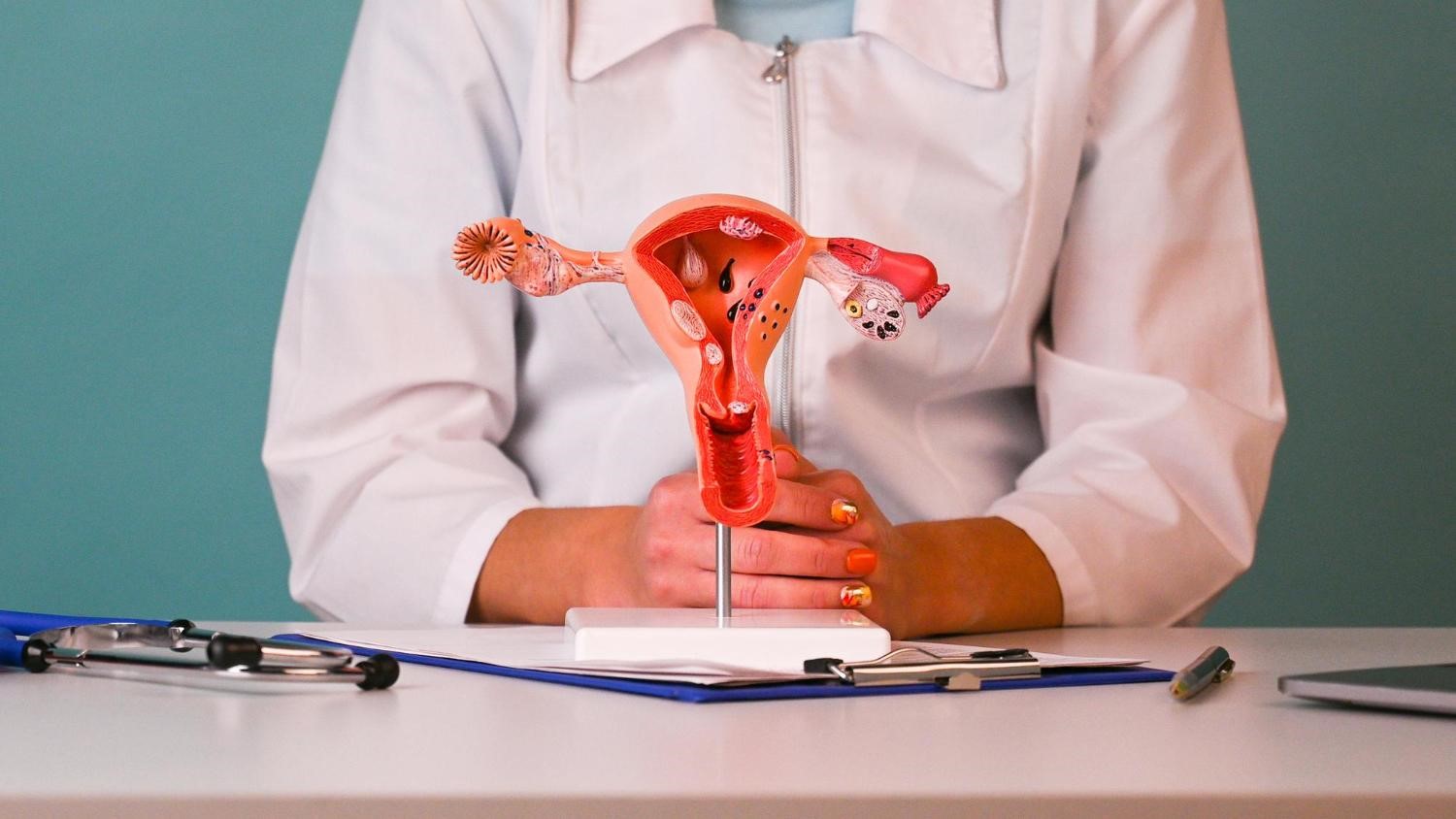 Polycystic Ovary Syndrome: Know the Basics and Take Control